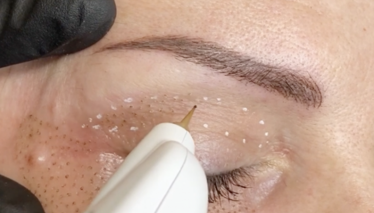 Formation Plasma lift - Linemakeup.com