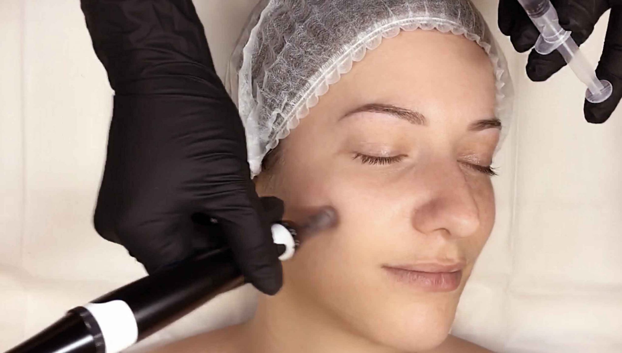 Microneedling - Linemakeup.com